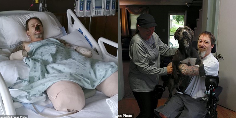 Njihuni me burrin që humbi këmbët, krahët dhe hundën e tij vetëm nga ...